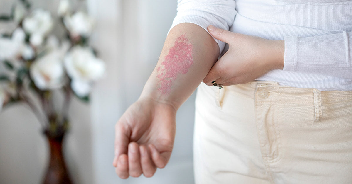What is Sensitization? – Plant Therapy